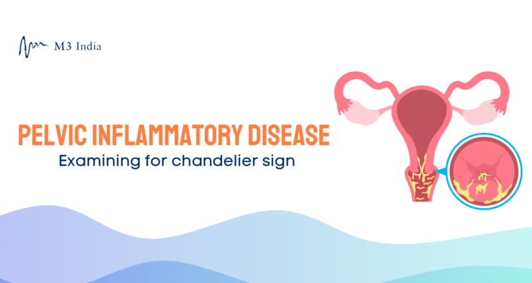 What is Chandelier’s Sign: Role in Early Detection of PID & Prevention