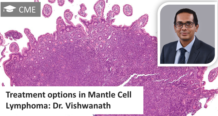 Treatment options in patients with mantle cell lymphoma (MCL)
