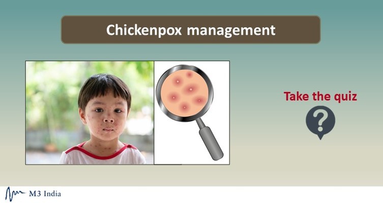 Chickenpox: Diagnosis and treatment- Take the quiz