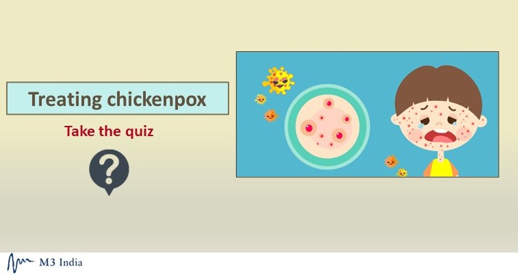 Treating the common chickenpox infection- Take the quiz