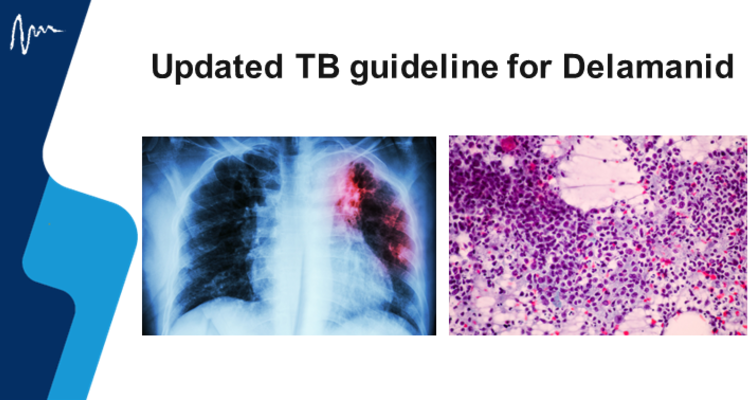 Updated TB guideline for Delamanid
