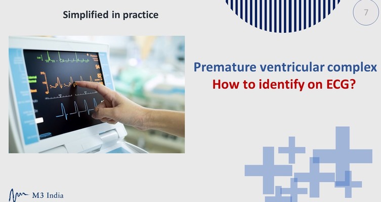 Understanding ECG features of ectopic heartbeats