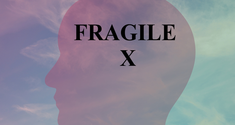 Fragile X syndrome caused by a "fragile" site at end of long arm of X-c