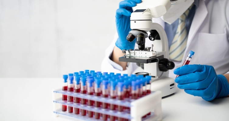 Indian startup develops AI-based blood test to detect 32 cancers early