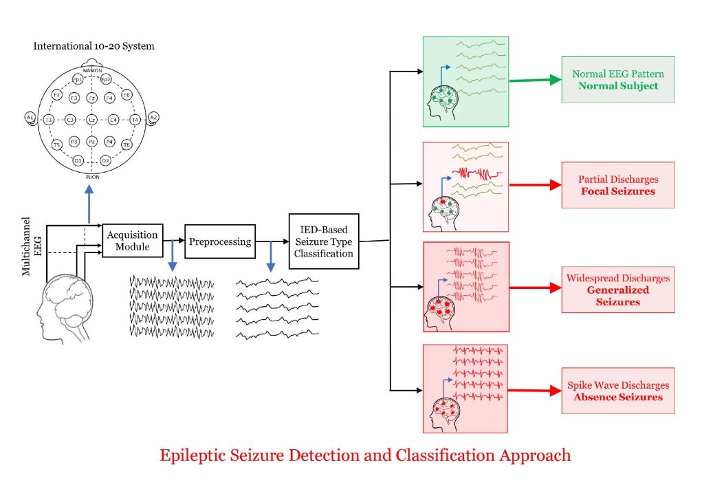 IISc Bengaluru develops algorithm that helps decode brain scans to ...