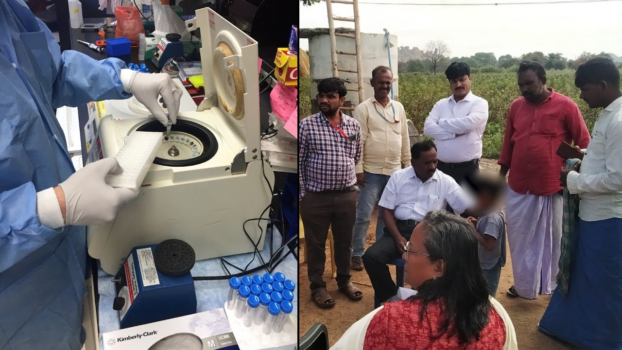 Zika virus: First case reported in Karnataka's Raichur - The South First Zika virus: First case reported in Karnataka's Raichur - The South First