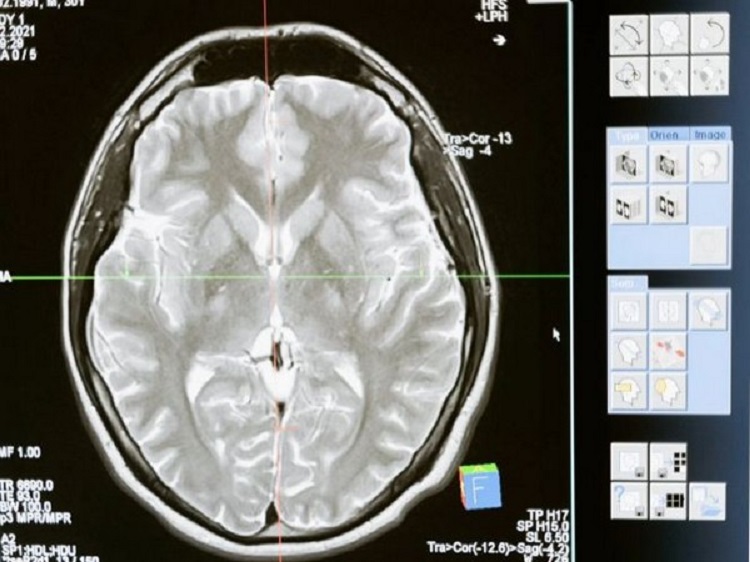 Scientists Create New Map Of Developing Cerebral Cortex | Dynamite News Scientists Create New Map Of Developing Cerebral Cortex | Dynamite News